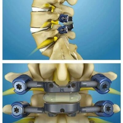 TOPS Procedure - Wisconsin Bone and Joint, SC